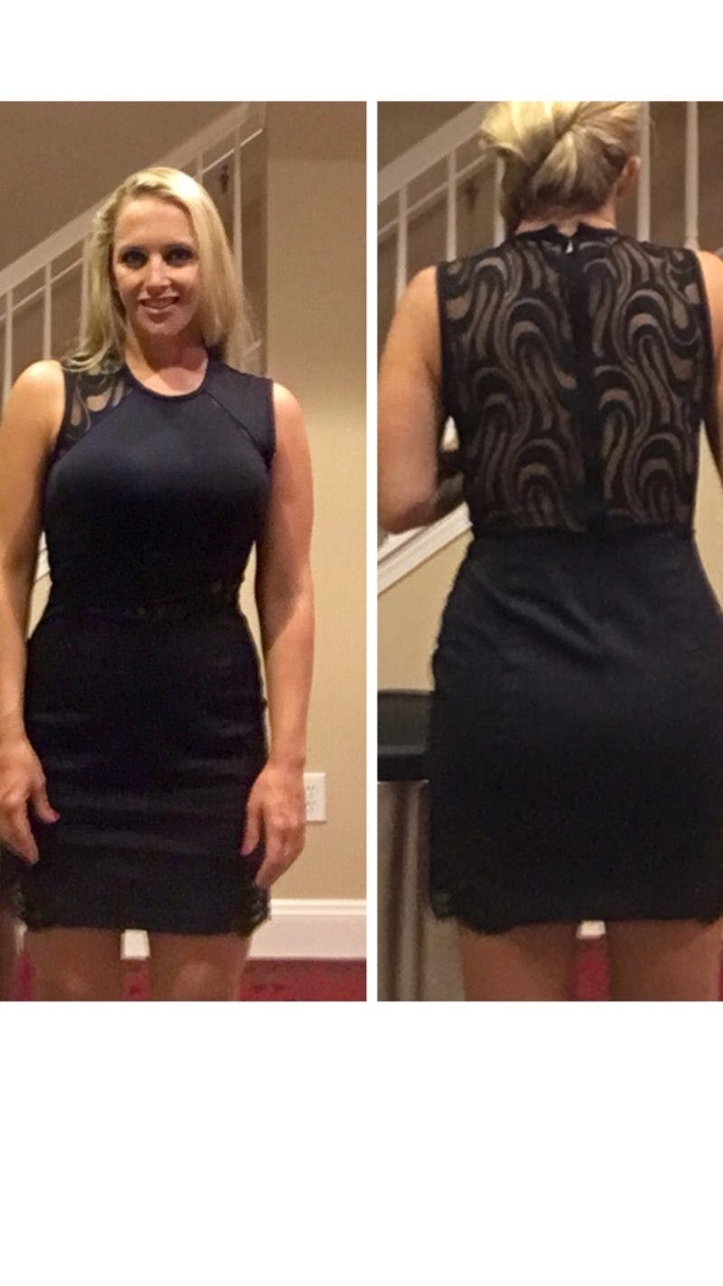 In This Skin Sheath by Cut 25 | Rent the Runway
